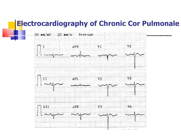 9.Cor Pulmonale