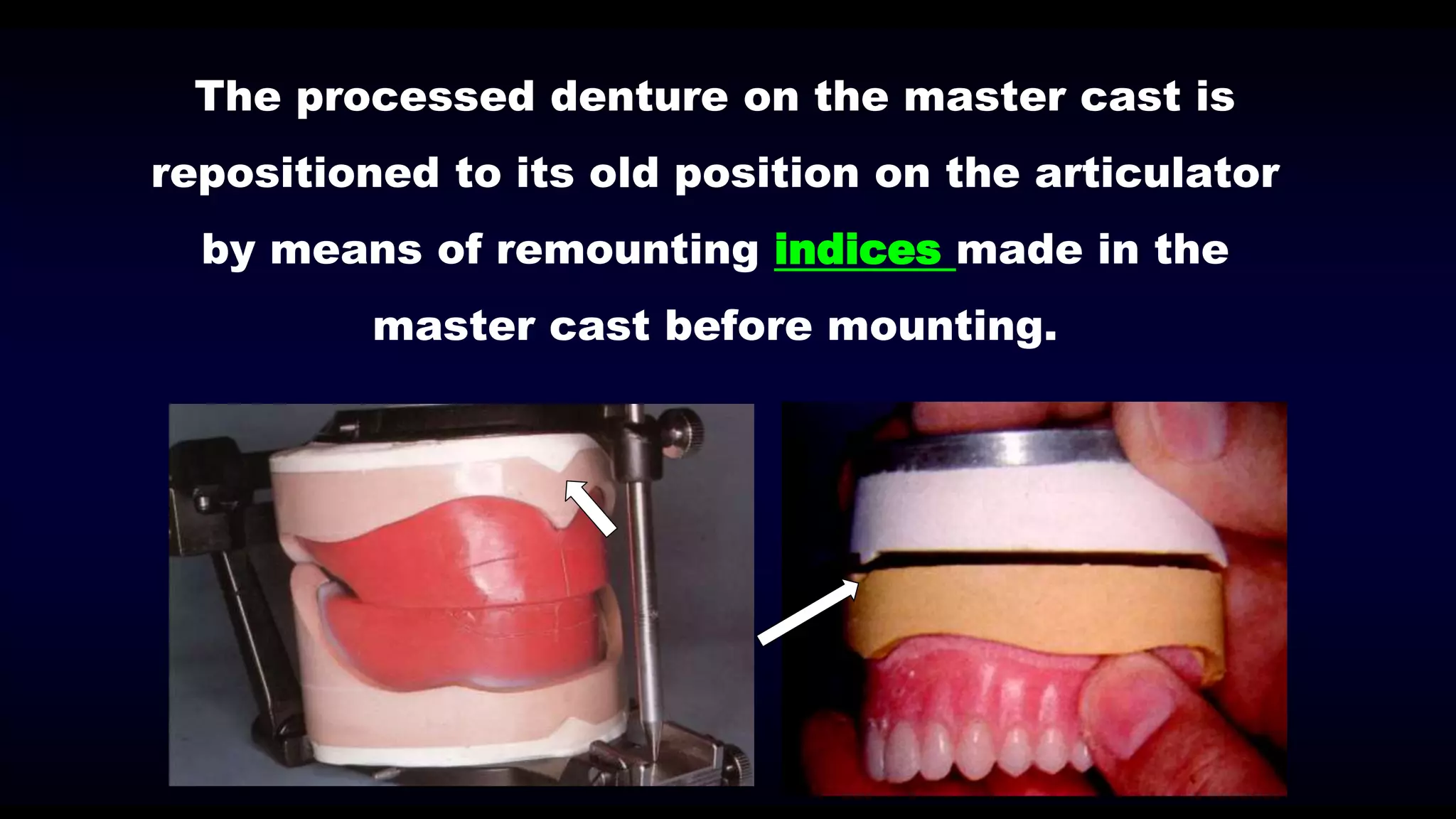 9- Denture placement and occlusion correction. | PPTX