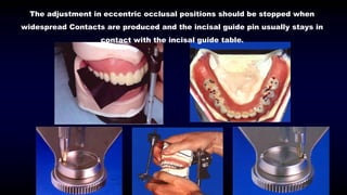 9- Denture placement and occlusion correction. | PPTX