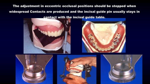 9- Denture Placement and occlusion correction.pptx