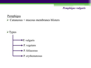 desquamative ginigivitis | PPTX