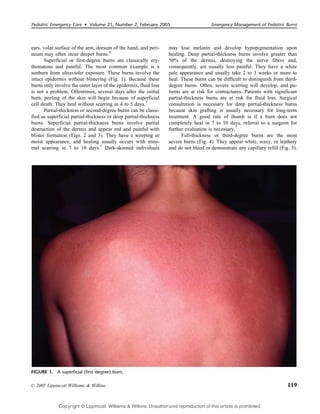 9 emergency mgmt of burns -peds emerg care 2005 | PDF