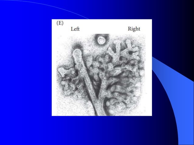 9 - Endodermal derivatives-53.ppt