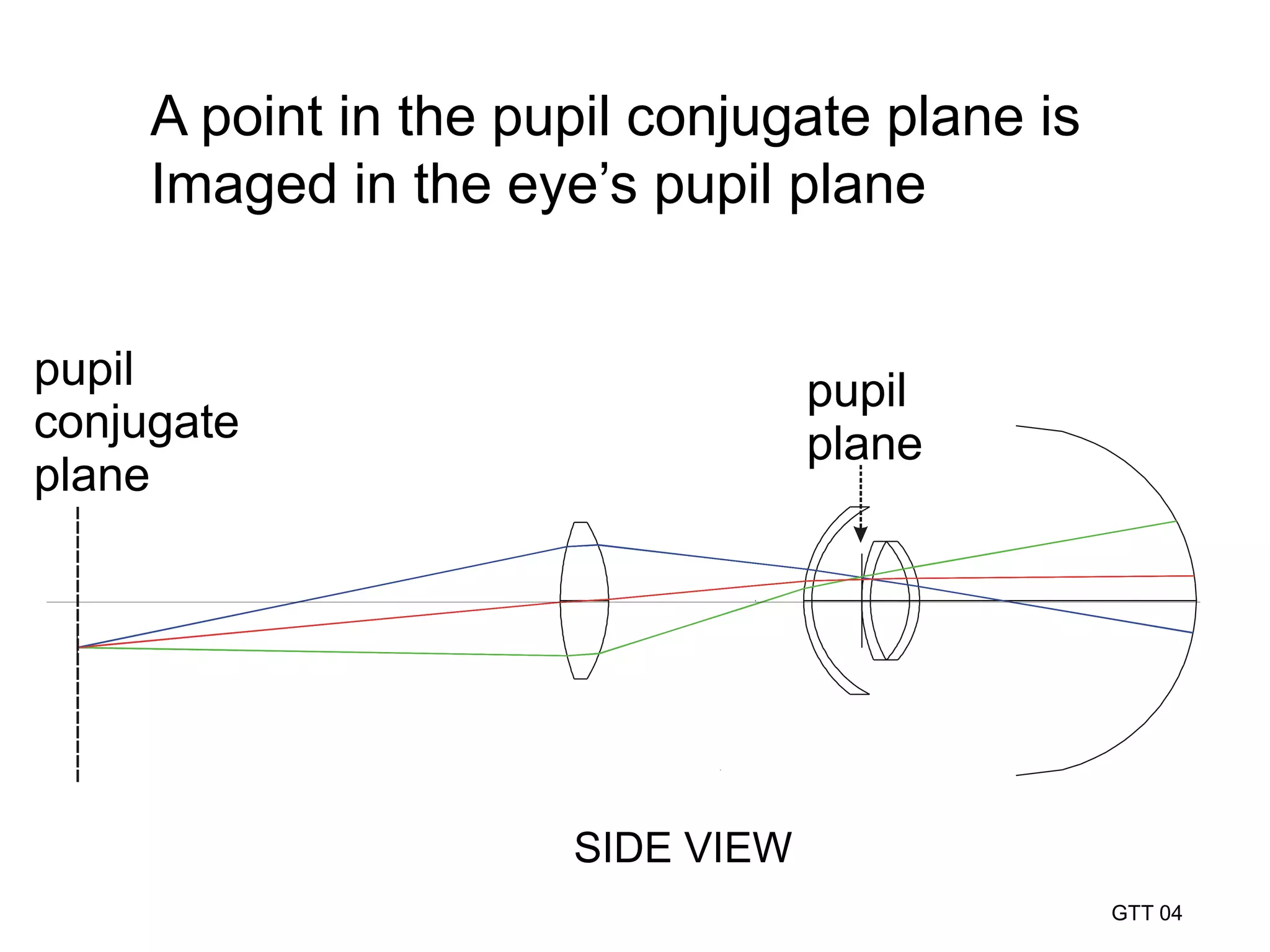 9-Indirect Ophthalmoscope.ppt