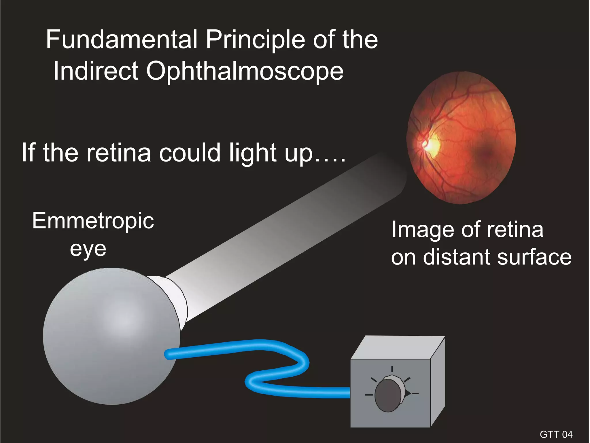 9-Indirect Ophthalmoscope.ppt