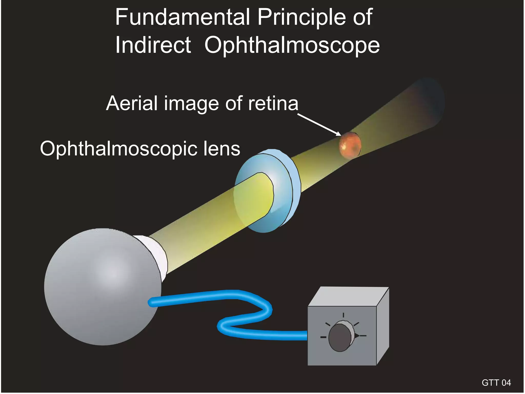 9-Indirect Ophthalmoscope.ppt