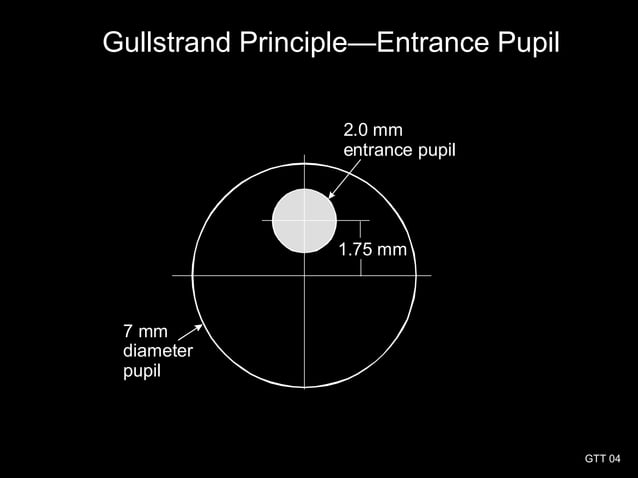 9-Indirect Ophthalmoscope.ppt