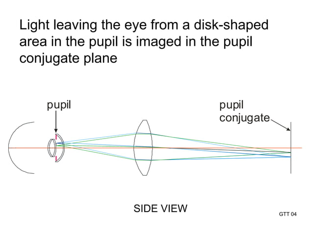 9-Indirect Ophthalmoscope.ppt