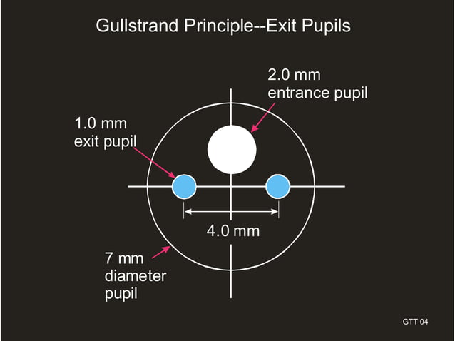 9-Indirect Ophthalmoscope.ppt