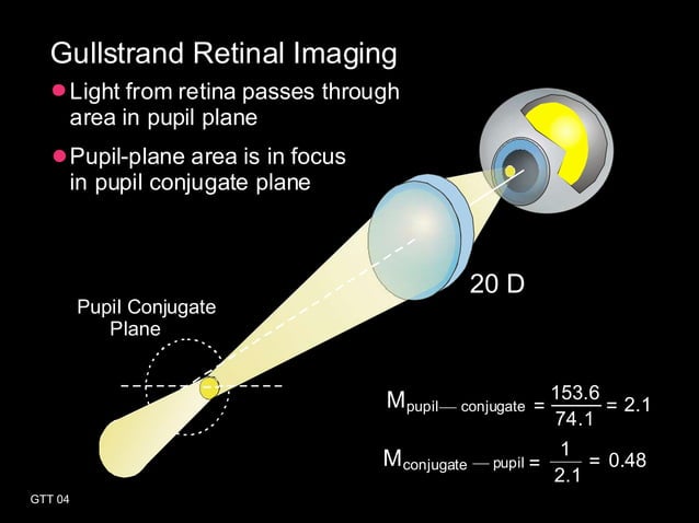 9-Indirect Ophthalmoscope.ppt