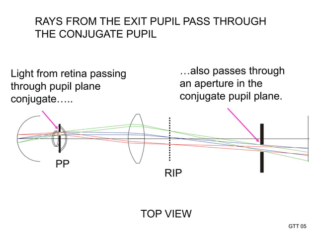 9-Indirect Ophthalmoscope.ppt
