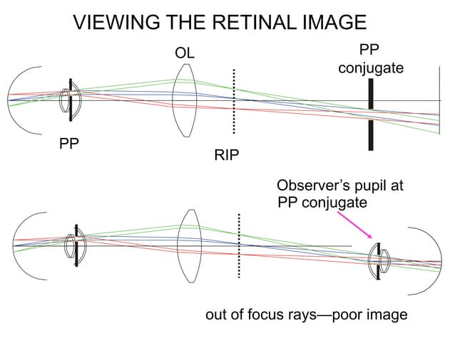 9-Indirect Ophthalmoscope.ppt