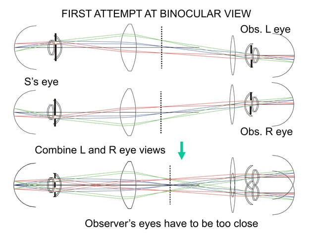 9-Indirect Ophthalmoscope.ppt