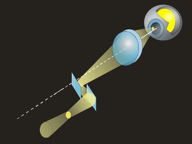 9-Indirect Ophthalmoscope.ppt