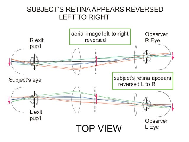 9-Indirect Ophthalmoscope.ppt