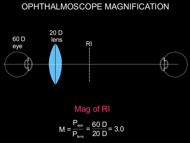 9-Indirect Ophthalmoscope.ppt