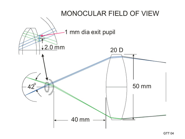 9-Indirect Ophthalmoscope.ppt
