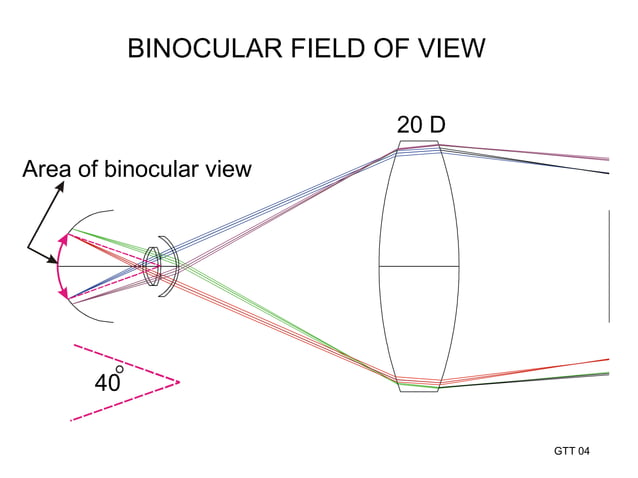 9-Indirect Ophthalmoscope.ppt