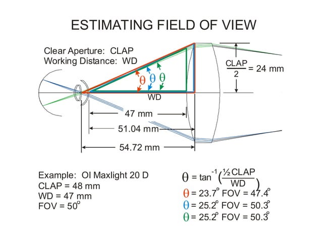 9-Indirect Ophthalmoscope.ppt