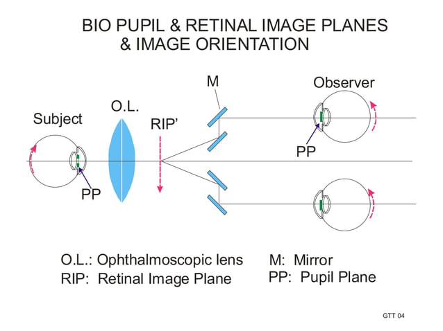 9-Indirect Ophthalmoscope.ppt