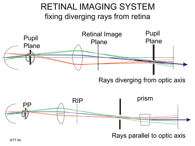 9-Indirect Ophthalmoscope.ppt