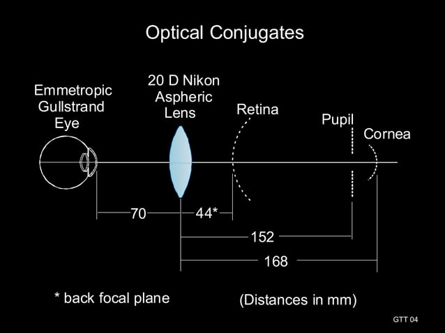 9-Indirect Ophthalmoscope.ppt