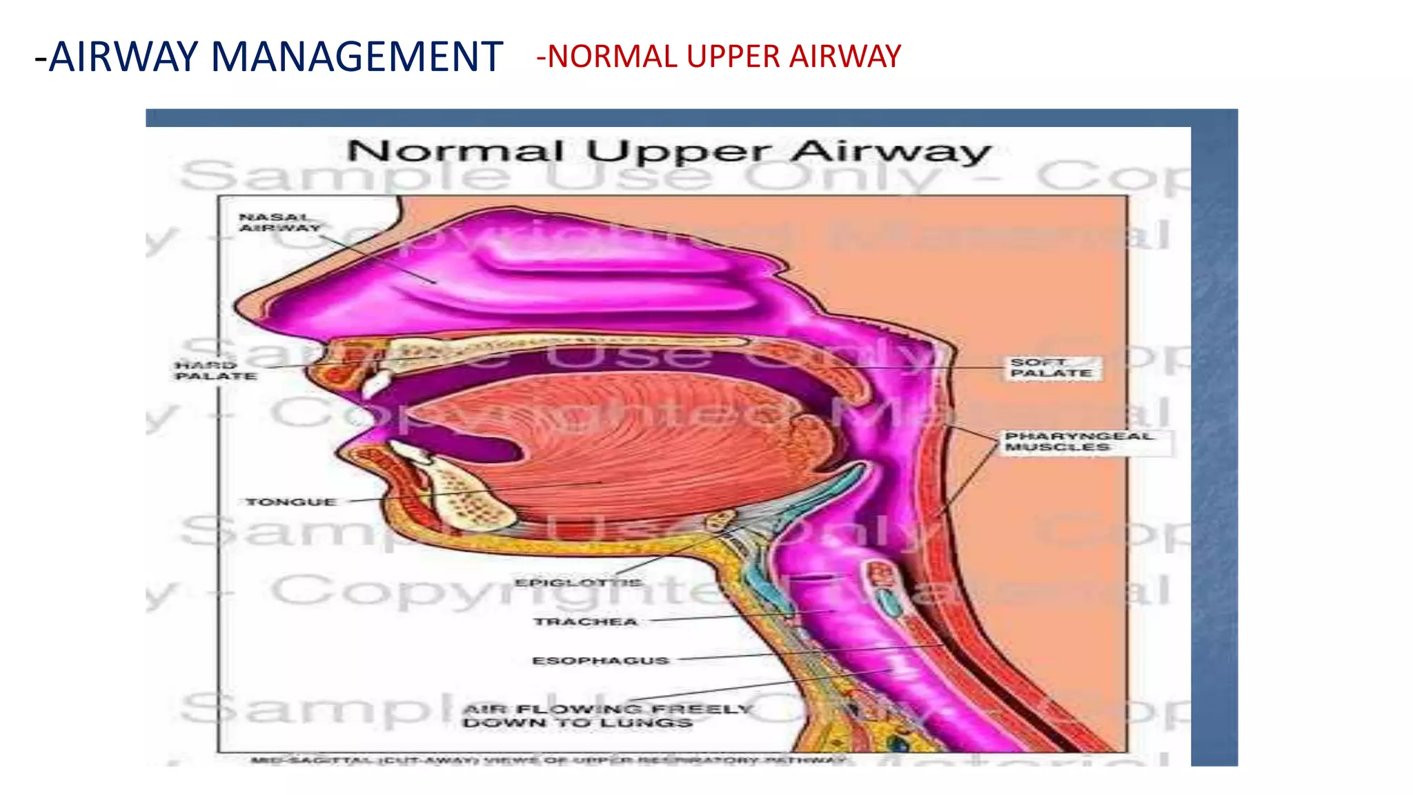 appropriate airway equipment and techniques-Anesthesia | PDF