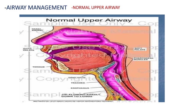 appropriate airway equipment and techniques-Anesthesia | PDF | Ear ...