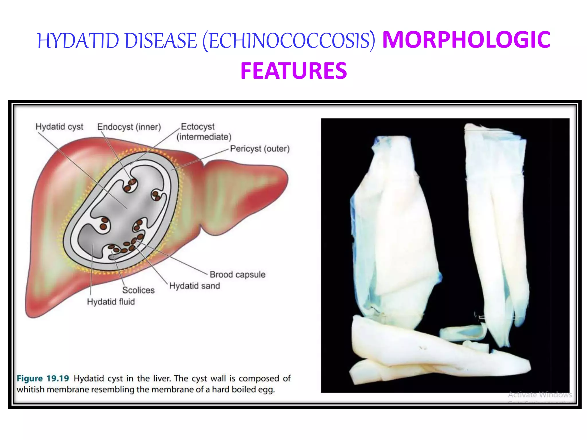 LIVER & GALLBLADDER PATHOLOGY | PPTX
