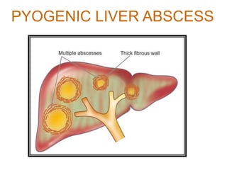 LIVER & GALLBLADDER PATHOLOGY | PPTX