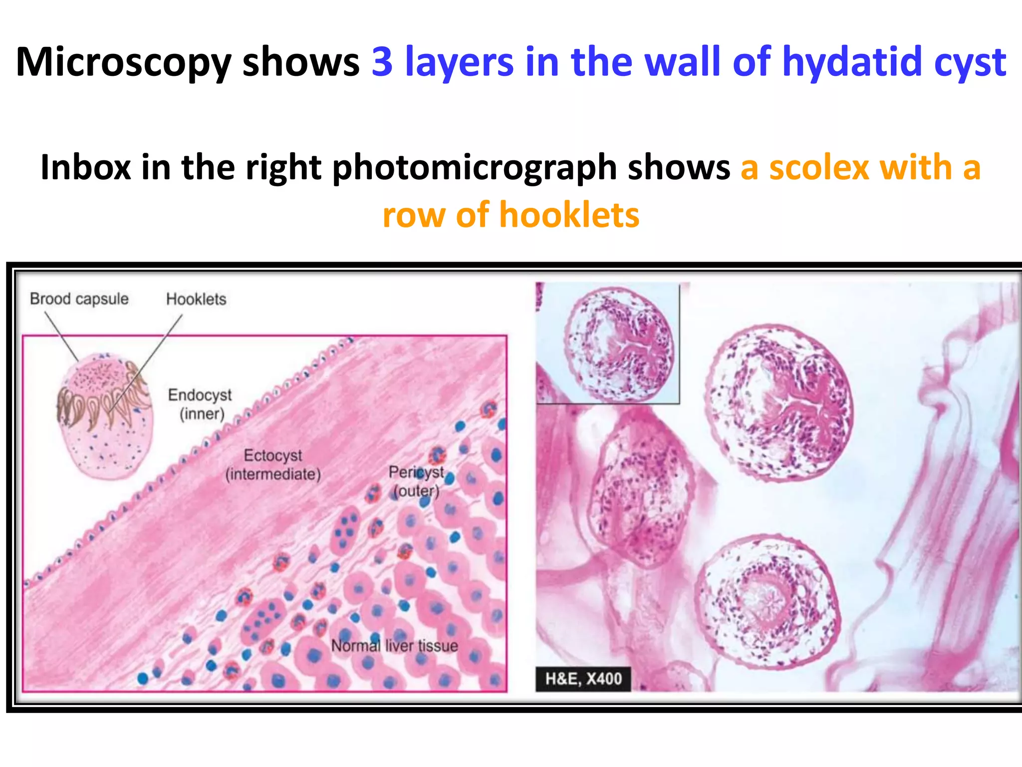 THE LIVER: ACUTE & CHRONIC HEPATITIS | PPTX