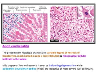 THE LIVER: ACUTE & CHRONIC HEPATITIS | PPTX