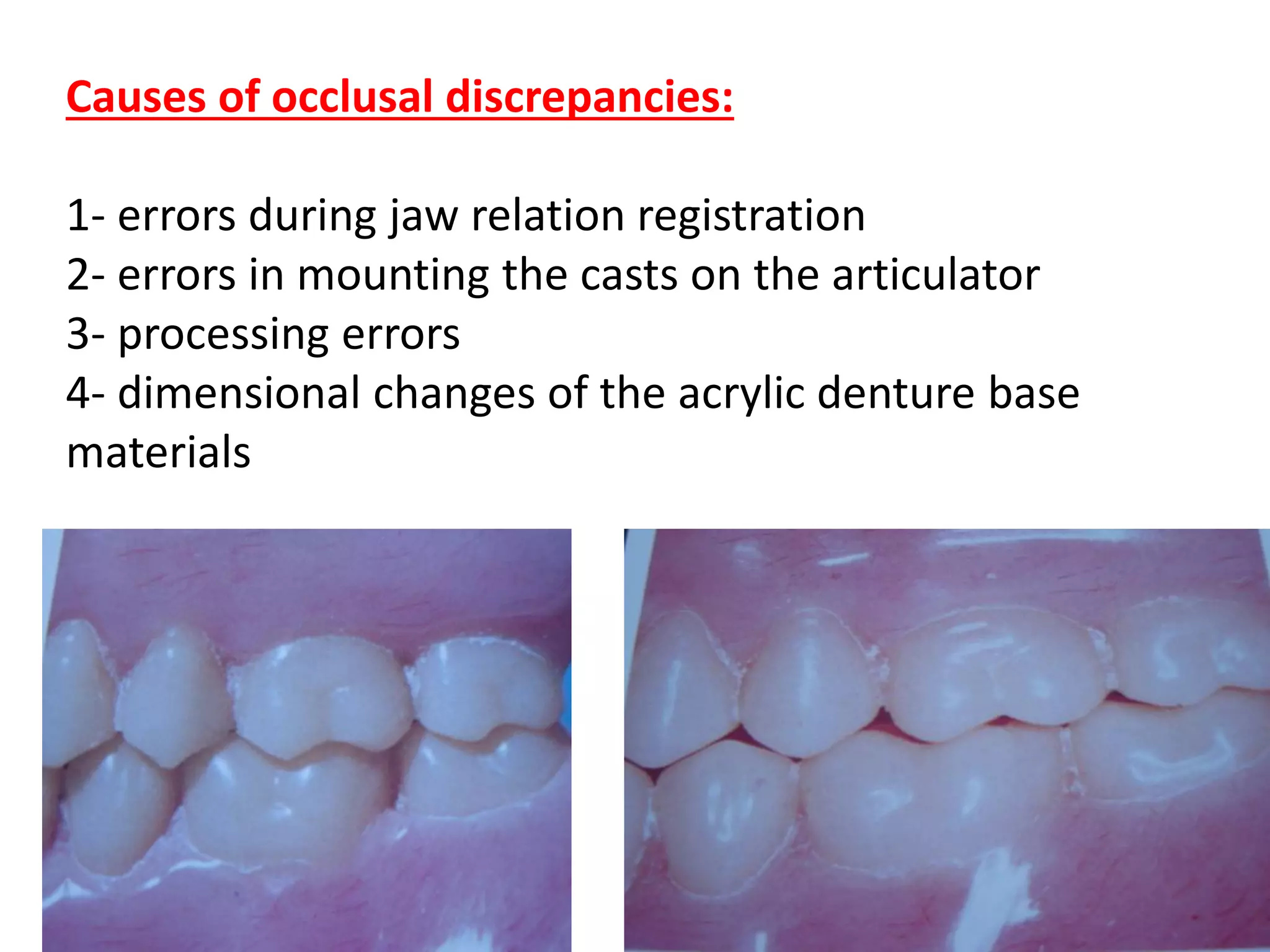 9 new denture insertion | PDF