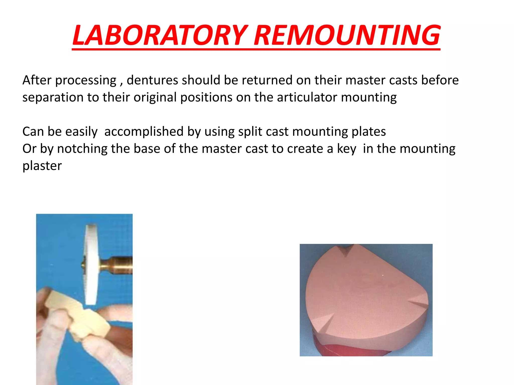 9 new denture insertion | PDF