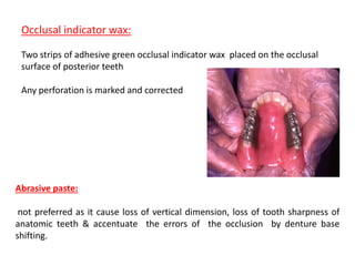 9 new denture insertion | PDF
