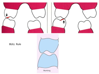 9 new denture insertion | PDF