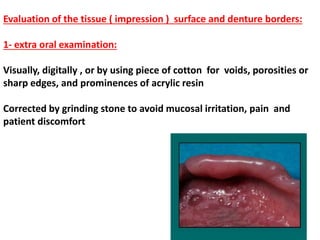 9 new denture insertion | PDF