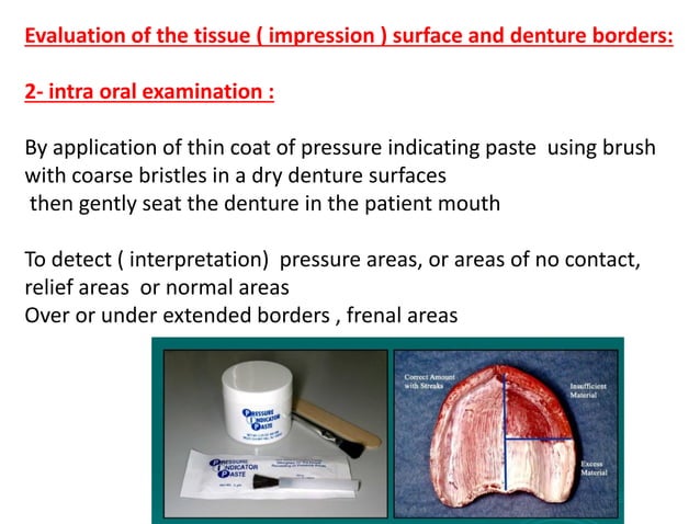 9 new denture insertion | PDF
