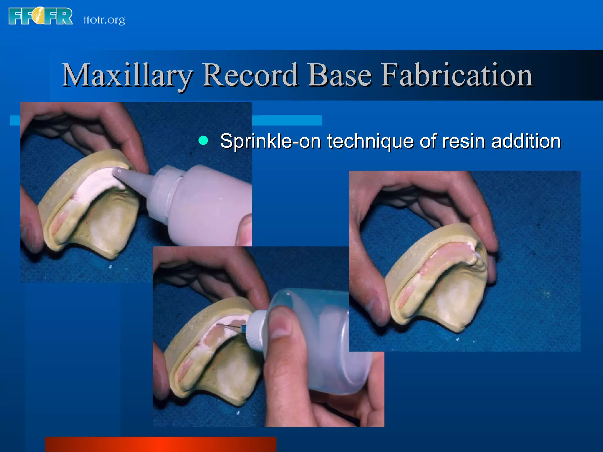 9.record base and wax rim fabrication | PPT