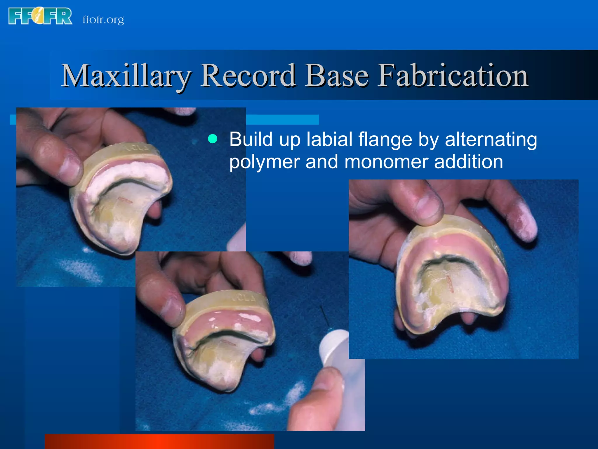 9.record base and wax rim fabrication | PPT