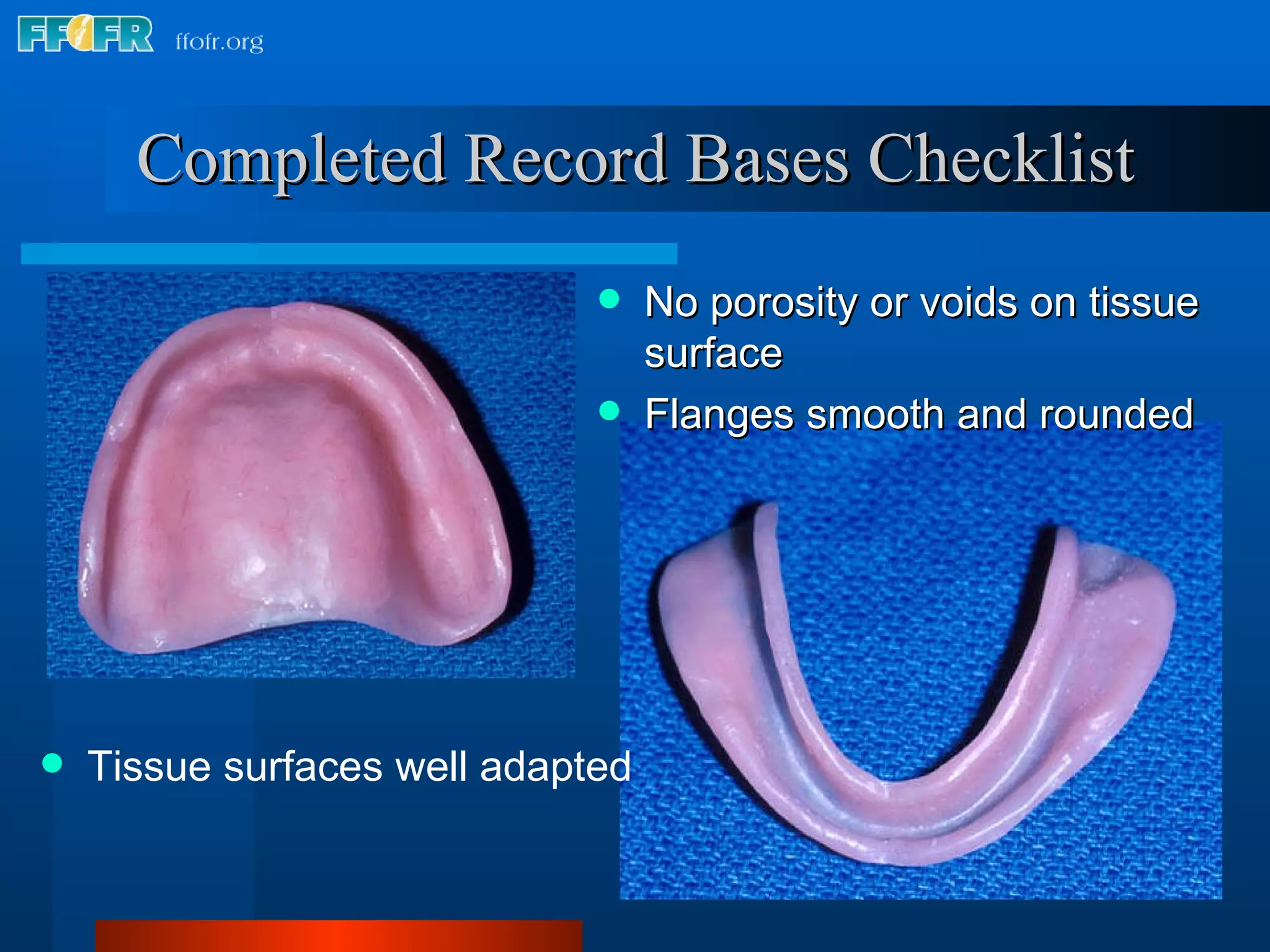 9.record base and wax rim fabrication | PPT