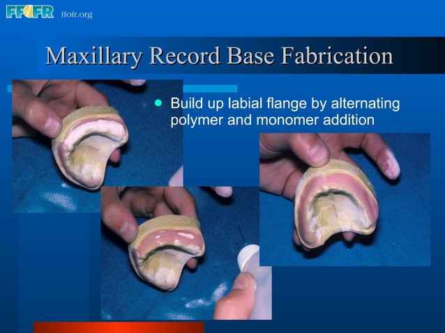 9.record base and wax rim fabrication | PPT