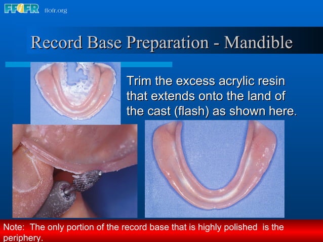 9.record base and wax rim fabrication | PPT