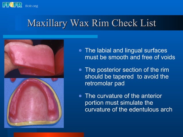 9.record base and wax rim fabrication | PPT