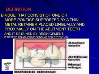 9_RESIN-BONDED_FIXED_PARTIAL_DENTURE.ppt
