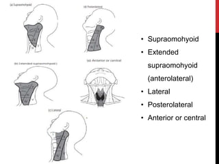 SELECTIVE NECK DISSECTION | PPTX