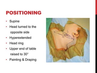 SELECTIVE NECK DISSECTION | PPTX