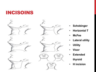 SELECTIVE NECK DISSECTION | PPTX