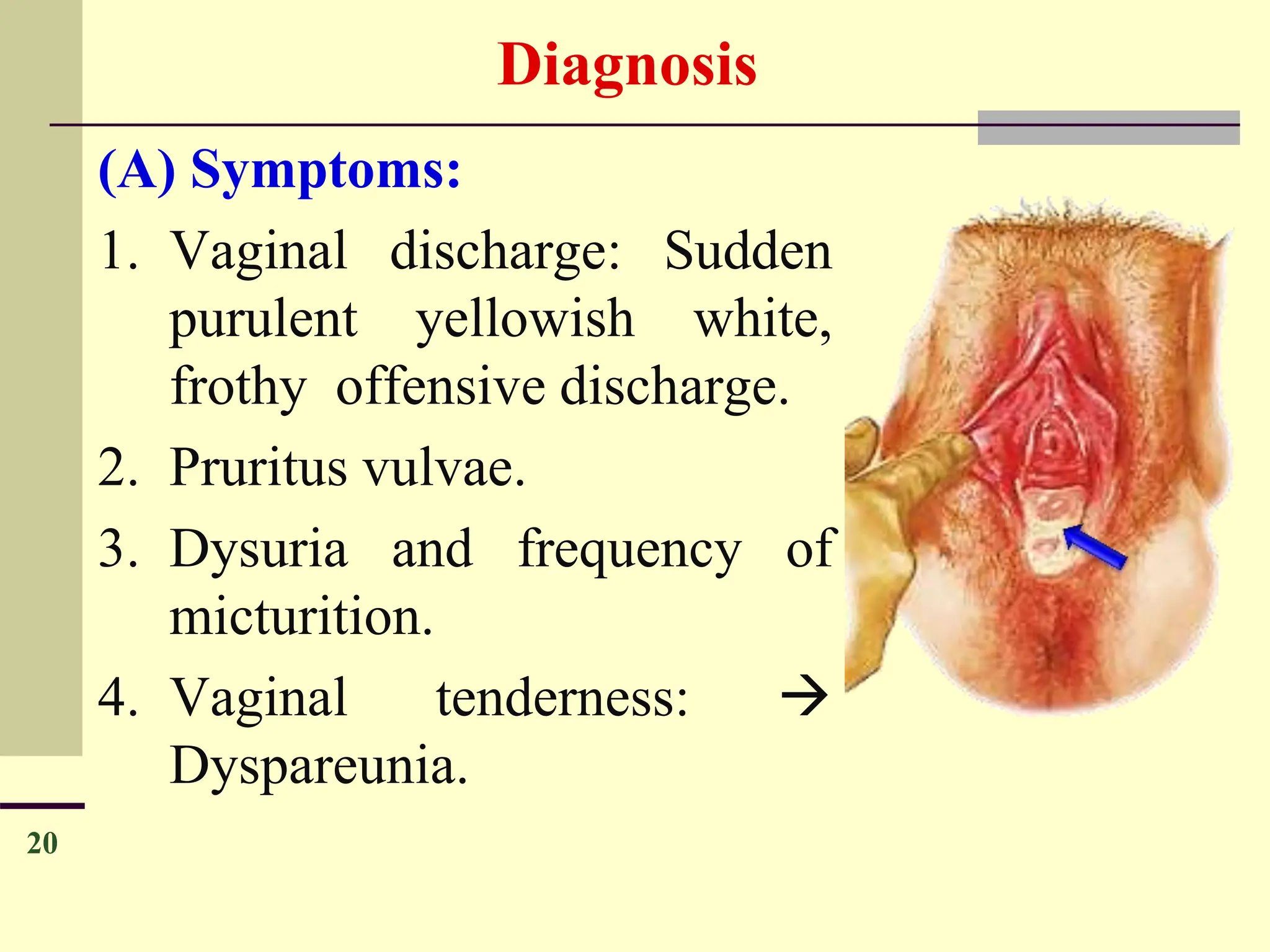 9 Sexual Transmitted Disease Modified Pptx