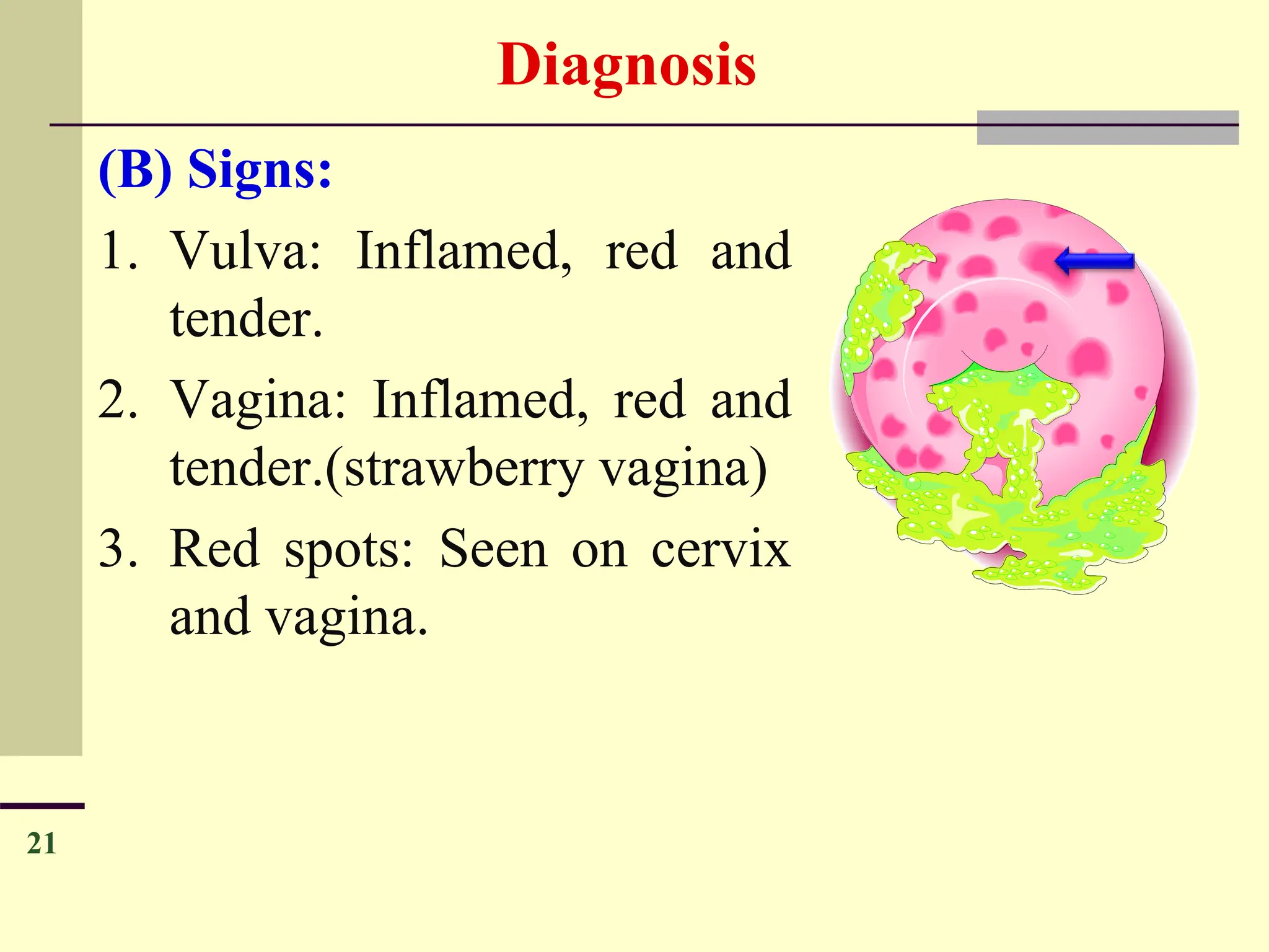 9 - sexual transmitted disease modified.pptx | Sexual Conditions | Sexual Health
